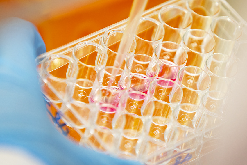 Patient-Derived Organoid Services | Drug Screens & Assays